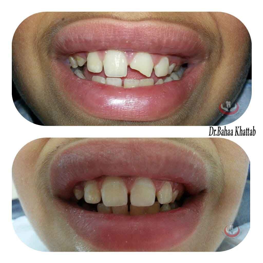 Conservative Dentistry Department - المركز العربي لطب الأسنان - Arab ...